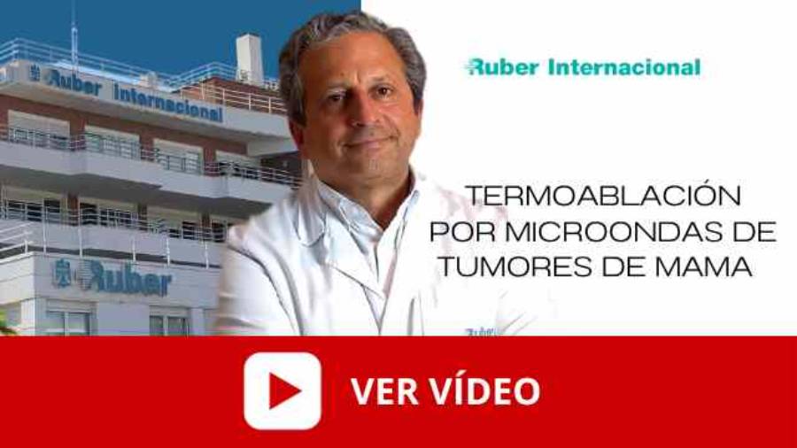 Termoablación por microondas para el tratamiento de tumores de mama
